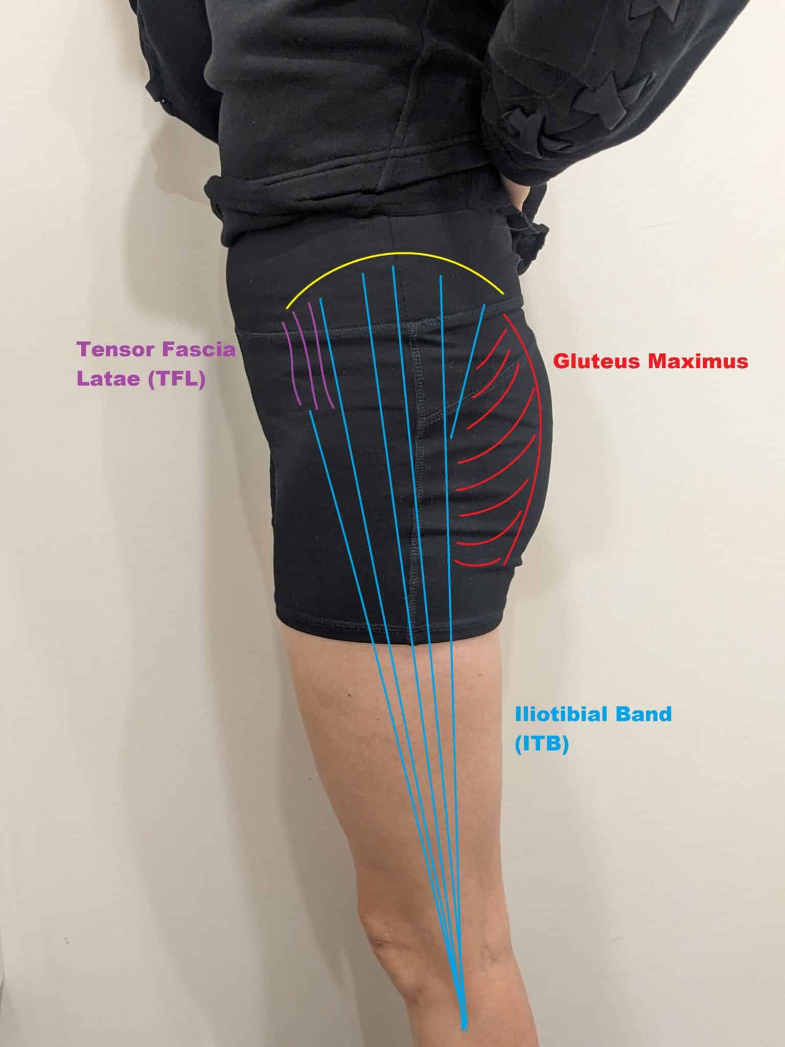 Iliotibial Band Friction Syndrome (ITBFS) | Contagious Enthusiasm